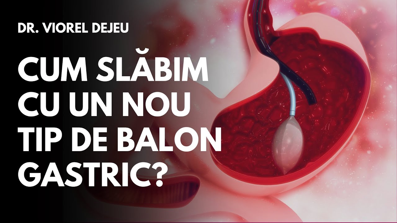 CUM SLĂBIM CU UN NOU TIP DE BALON GASTRIC? | dr. Viorel Dejeu ...
