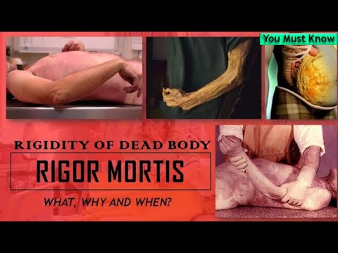 Human Livor Mortis