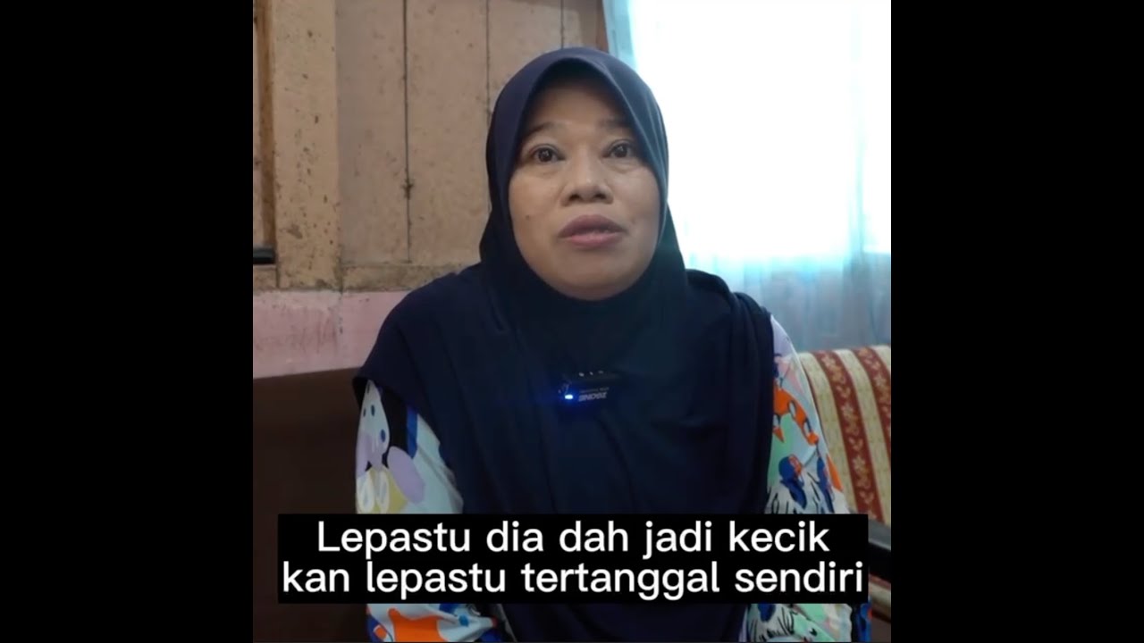 OLIVETIN-Tiada lagi masalah kutil selepas amalkan olivetin - YouTube OLIVETIN-Tiada lagi masalah kutil selepas amalkan olivetin - YouTube