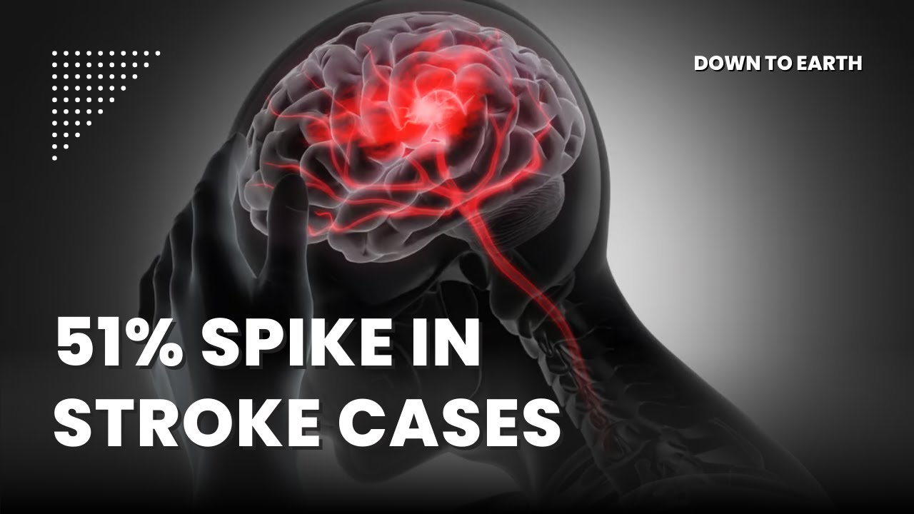 Global stroke rates climb, India faces 51% spike in cases over 30 years ...
