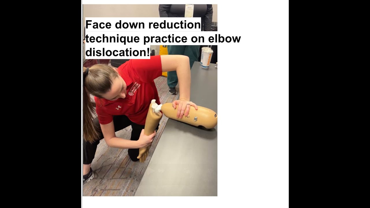 Elbow Dislocation face down reduction | Sports Medicine | Athletic ...