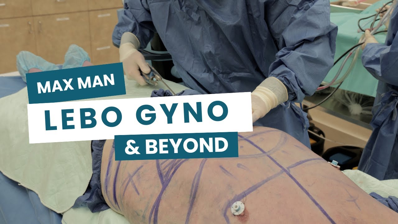 MAX MAN LEBO GYNO & BEYOND 50 ORANGE COUNTY CALIFORNIA MALE, GETS THE ...