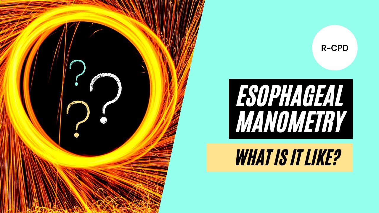 Esophageal Manometry | WHAT IS IT LIKE? - YouTube