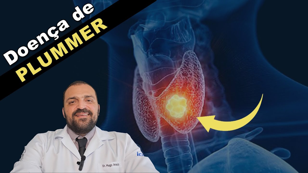 O QUE É A DOENÇA DE PLUMMER? - YouTube