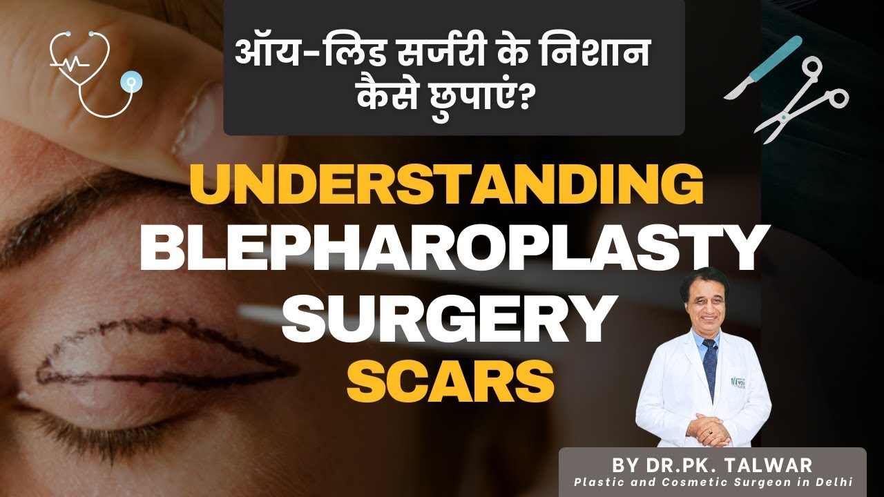 Change Eye Shape by Blepharoplasty Surgery | Eyelid Surgery in Mumbai ...