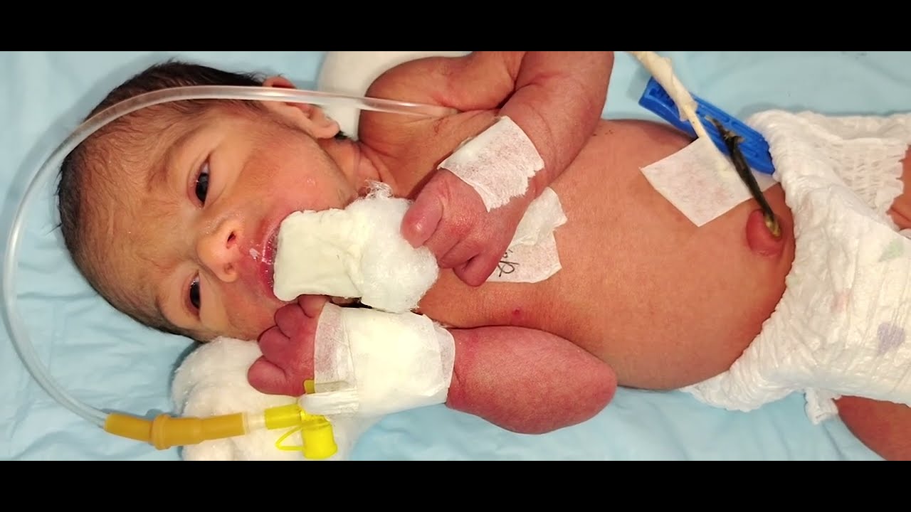 New born very big male baby delivred by lscs baby is hungry birds very ...