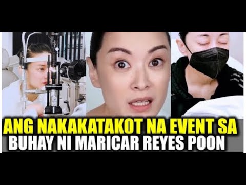 Maricar Reyes Muntik Ng Mabulag Dahils a Contact Lens! - YouTube