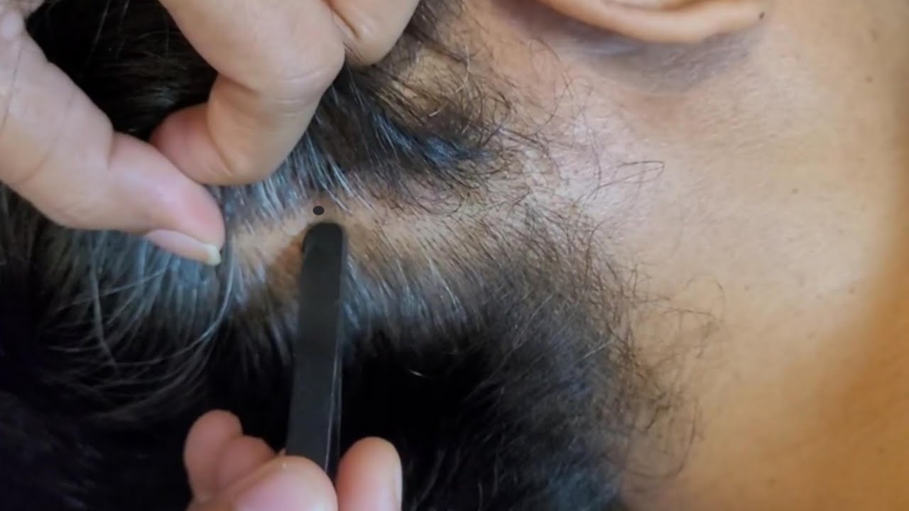 Scalp Check & Treatment ASMR (Triggers: Crinkle, Oil, Tapping, Massage ...