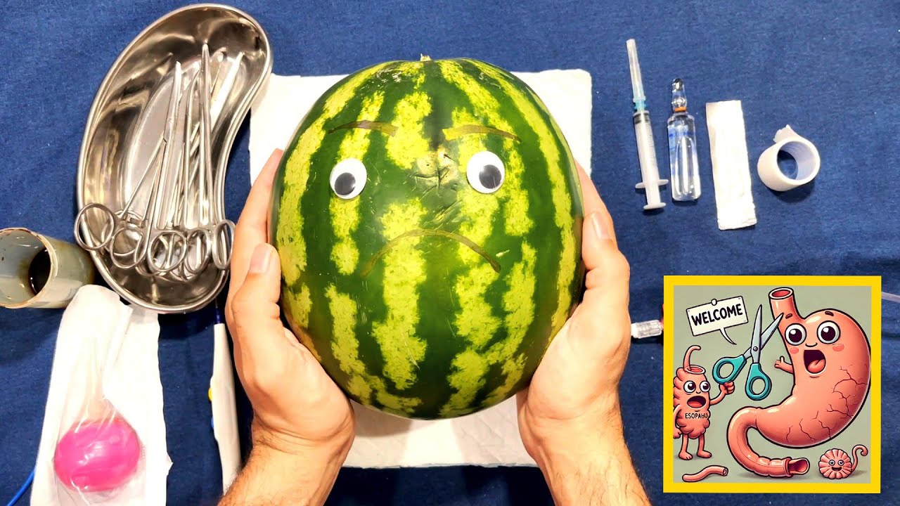 ASMR Fruit Surgery | Gastric bypass | bariatric surgery | Slimming ...