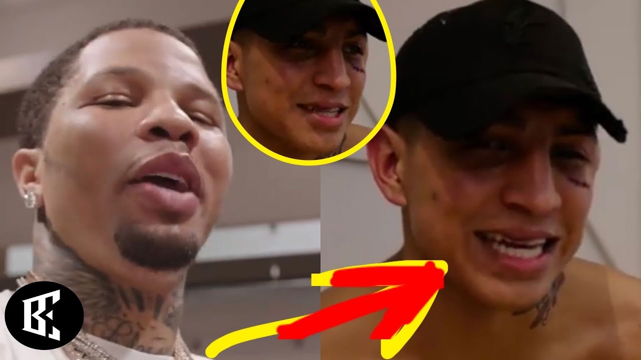 (WOW)! GERVONTA DAVIS VS. MARIO BARRIOS INITIAL LOOK POST- FIGHT FACES ...