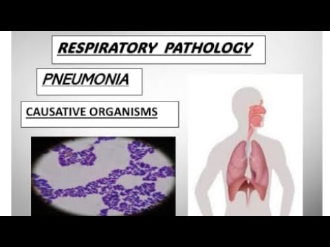 Respo pathology - PNEUMONIA (causative organism ) #pneumonia #pathology ...