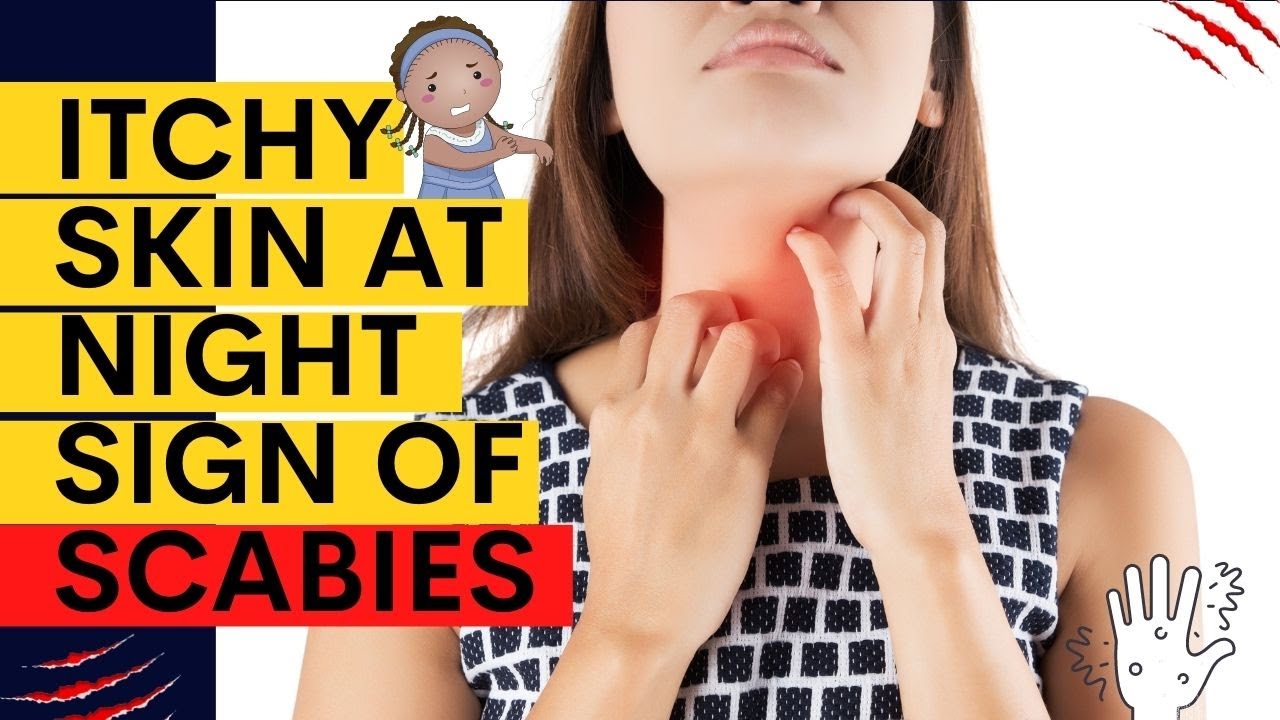 Itchy Skin Remedies - Sign Of Scabies | 8 Home Treatment For Scabies ...