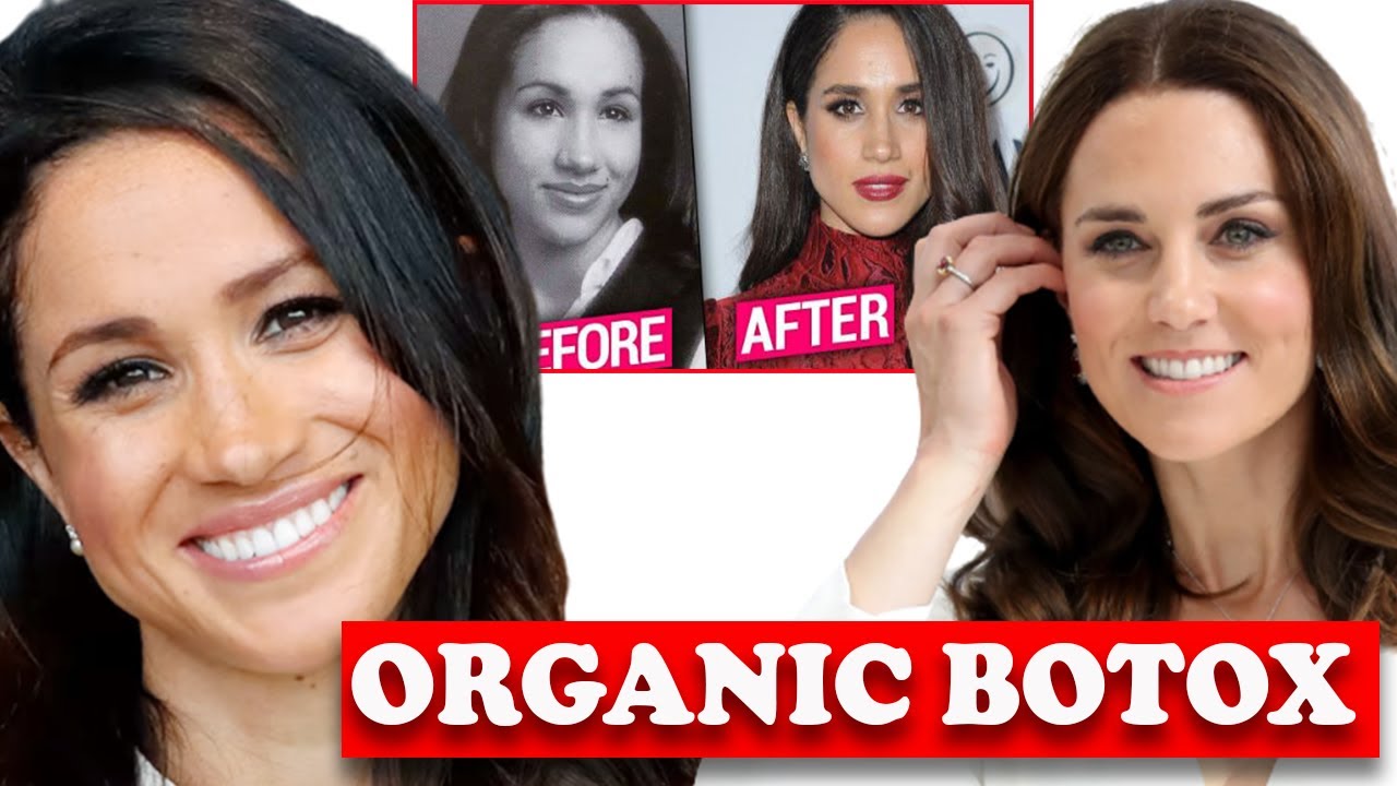 ORGANIC BOTOX! Meg HUMILIATED As She Becomes The Subject Of PLASTIC ...