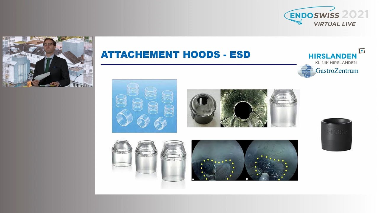 Tips and tricks for ESD: attachment hoods - YouTube