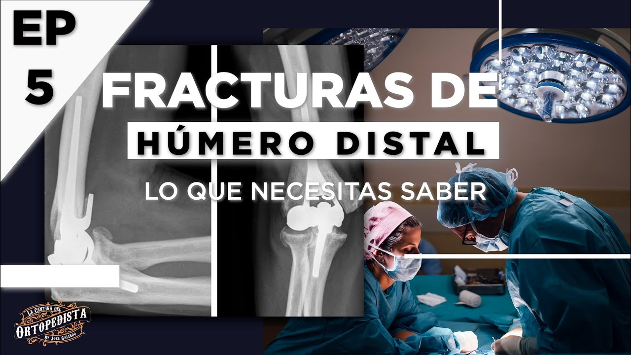 Fracturas del húmero distal - YouTube