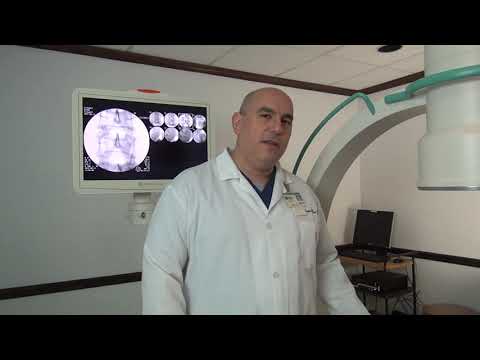 Pain - First Choice Neurology - Dr. Antonio Mesa - YouTube