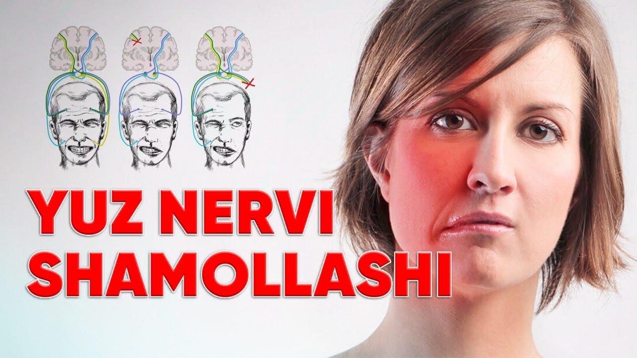 YUZ NERVI SHAMOLLANISHI // YUZ NERVI SHAMOLLANISHINI DAVOLASH YUZ ...