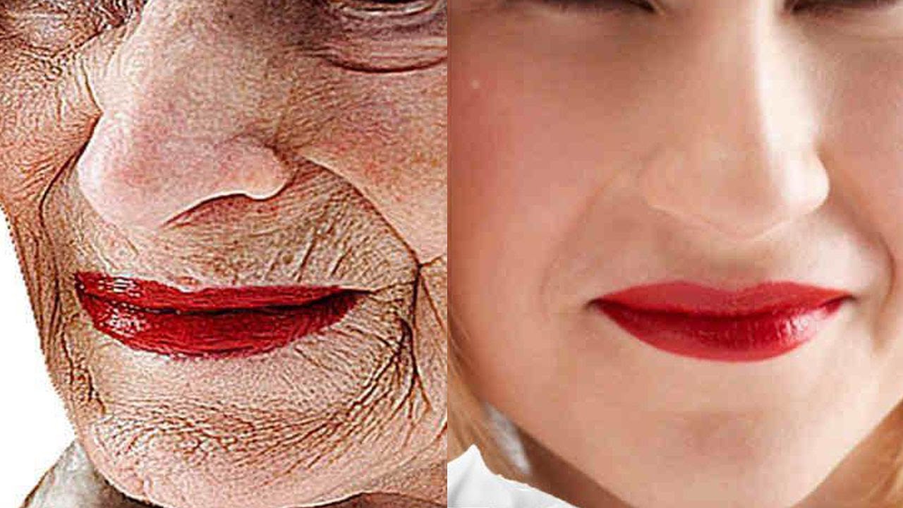 Remove All Wrinkles On Your Face Permanently | Magical Remedy To Remove ...