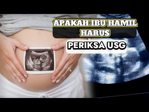 Ibu Hamil Harus Tahu! Pentingnya USG untuk Pantau Kesehatan Janin! #kesehatanibuhamil