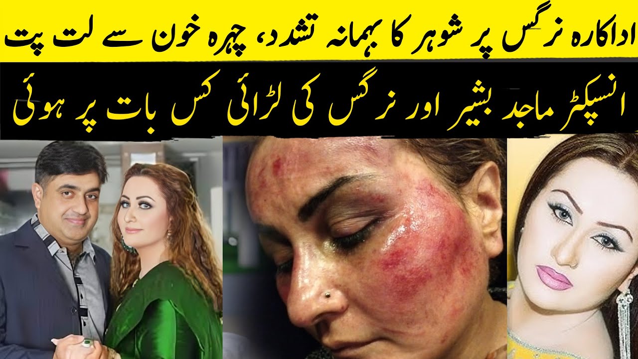 Pakistani Actress Nargis allegedly assaulted by husband, Inspector ...