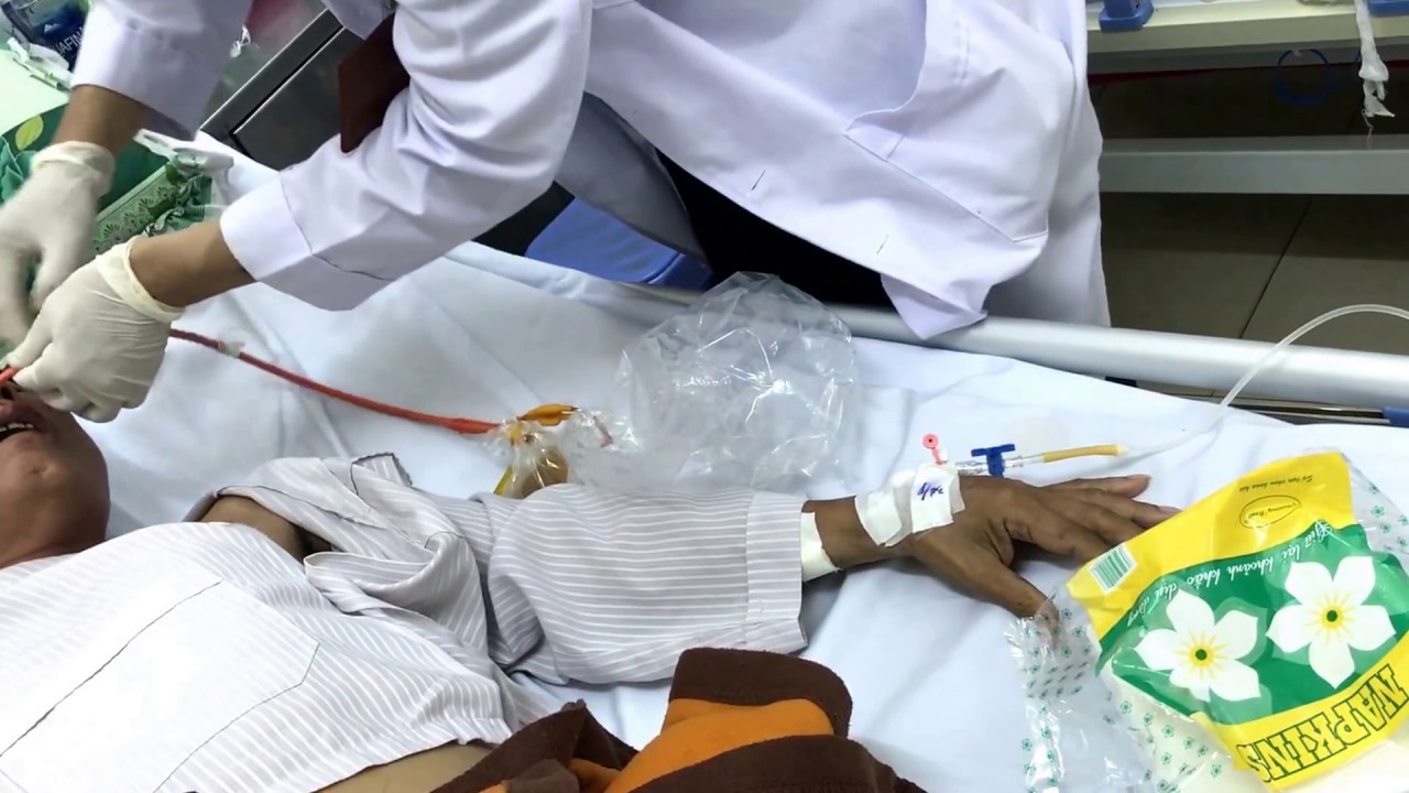 Rút thông Sengstaken Blakemore (Sengstaken Blakemore tube withdrawal ...