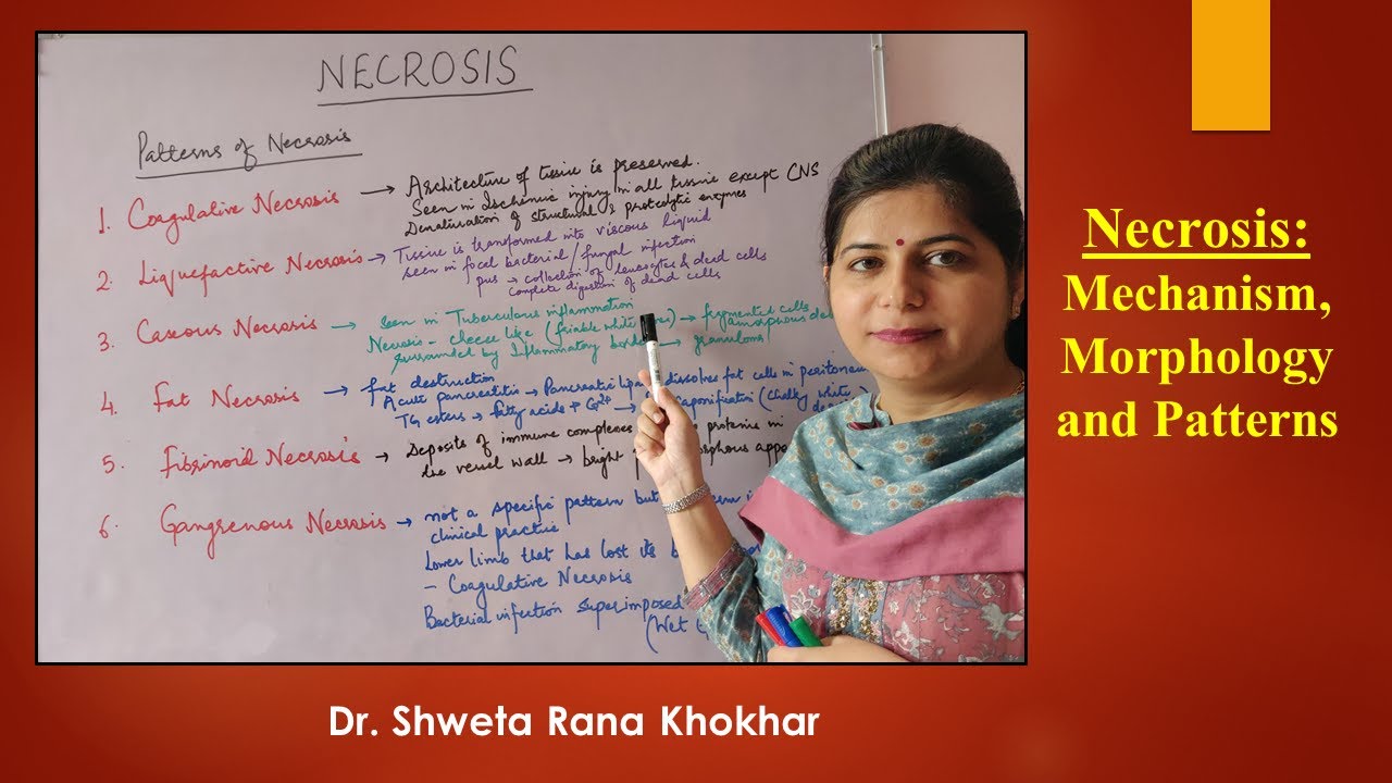 Necrosis: Mechanism, Morphology, Various Patterns with examples ...