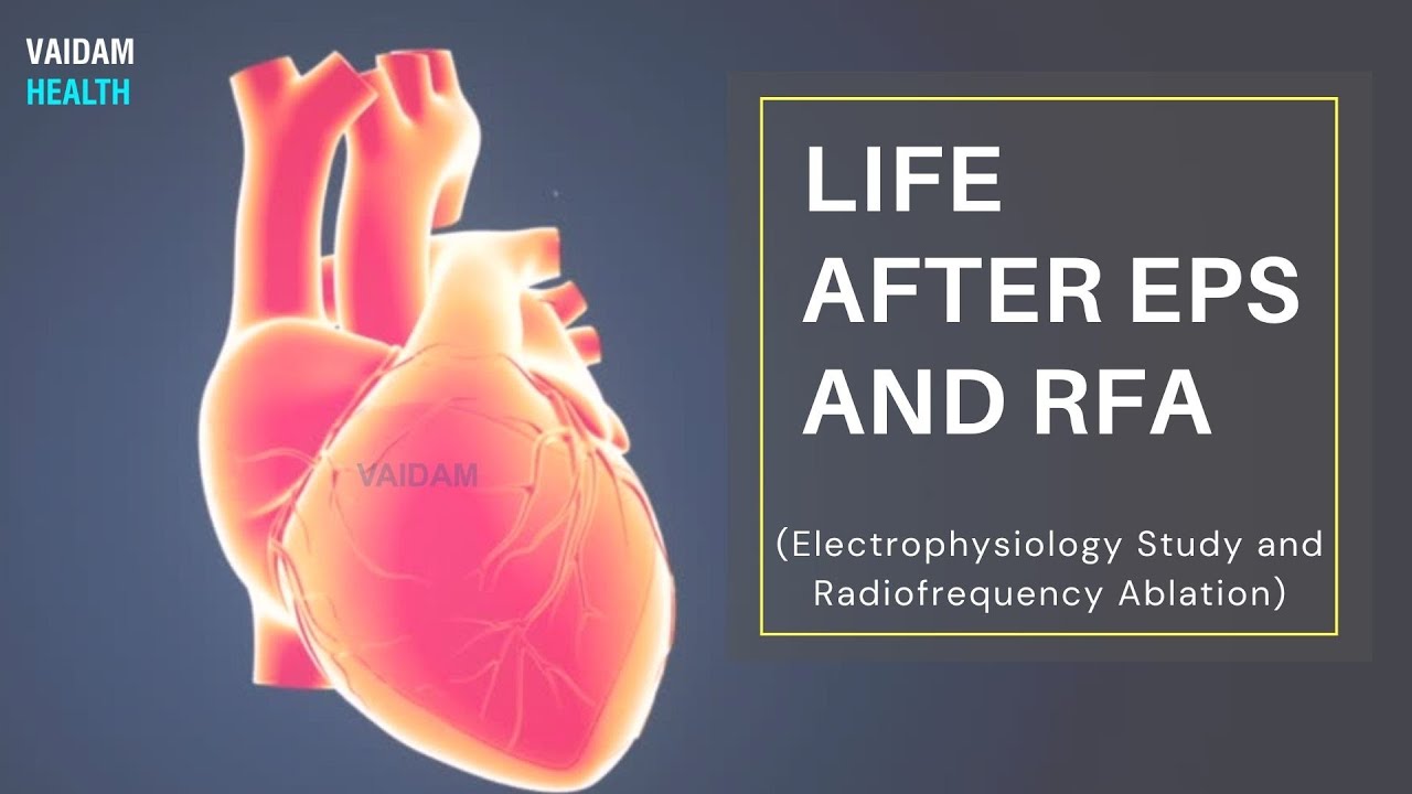 EPS RF Ablation Frequently Asked Questions 60 OFF