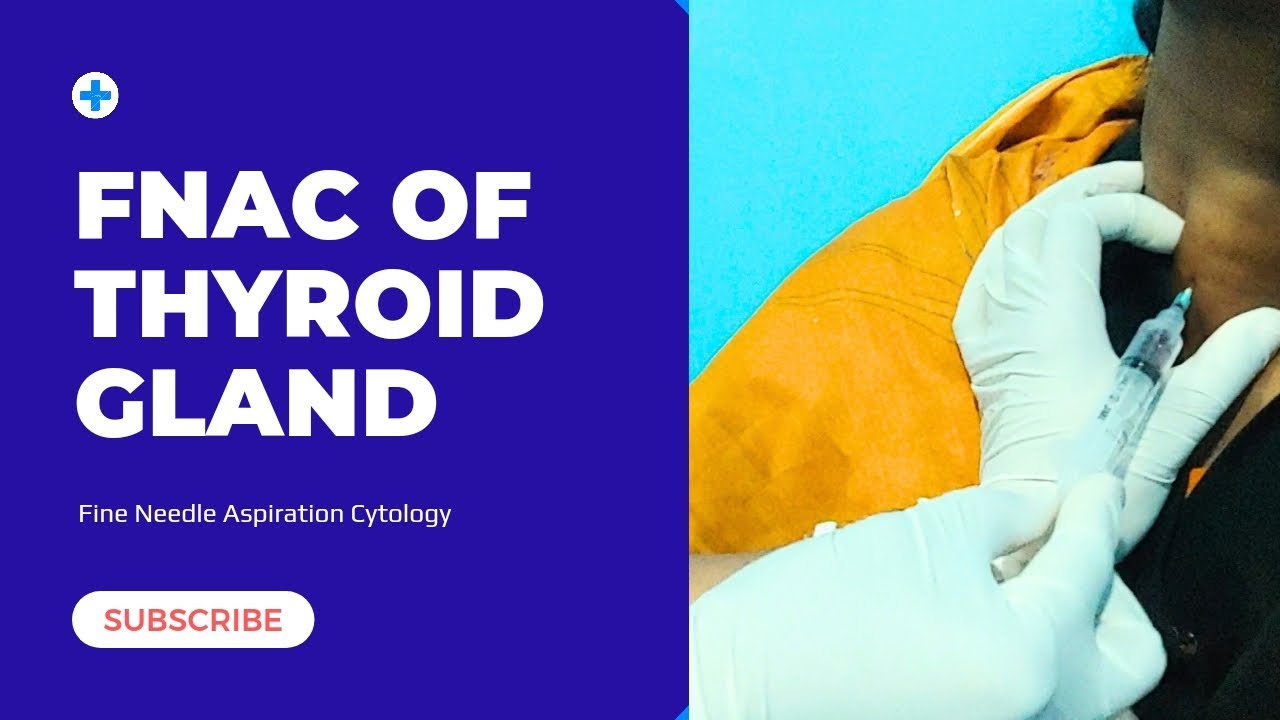 FNAC of Thyroid Gland।। - YouTube