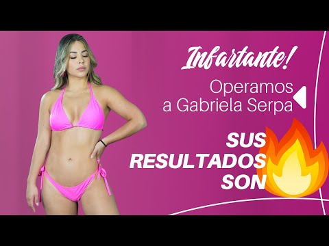 MARCACIÓN ABDOMINAL GABRIELA SERPA