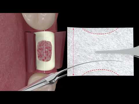 How To Use - RTR+ & RTR Membrane - YouTube