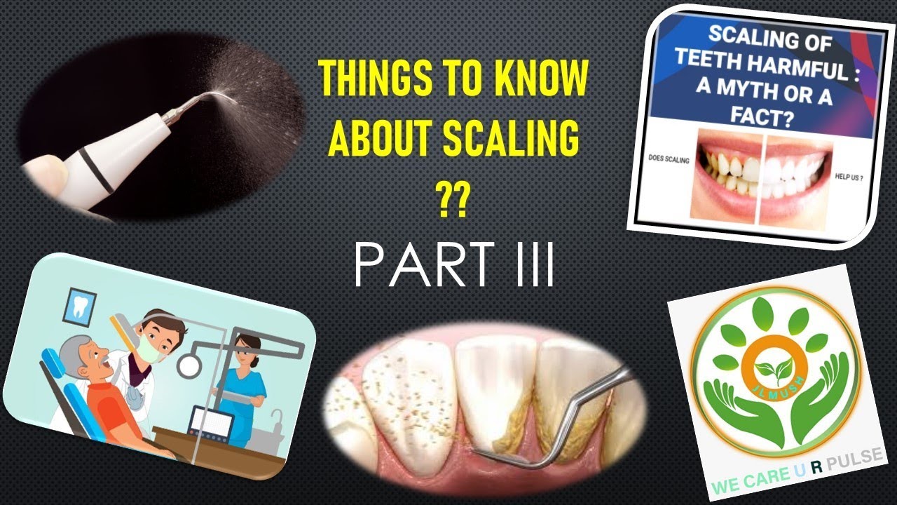 Things to know about scaling-Part 3 - YouTube