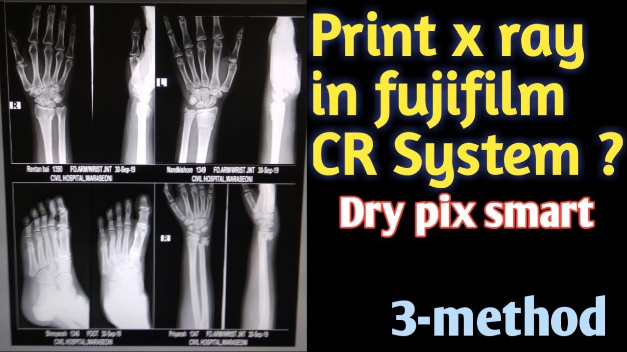 How to print X-Ray in Fujifilm CR System । CR system tutorial । Uday ...
