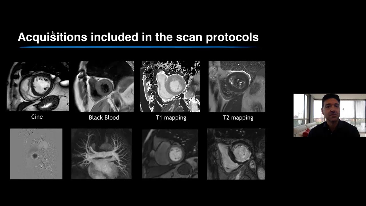 Cardiac imaging with MR 5300 - YouTube