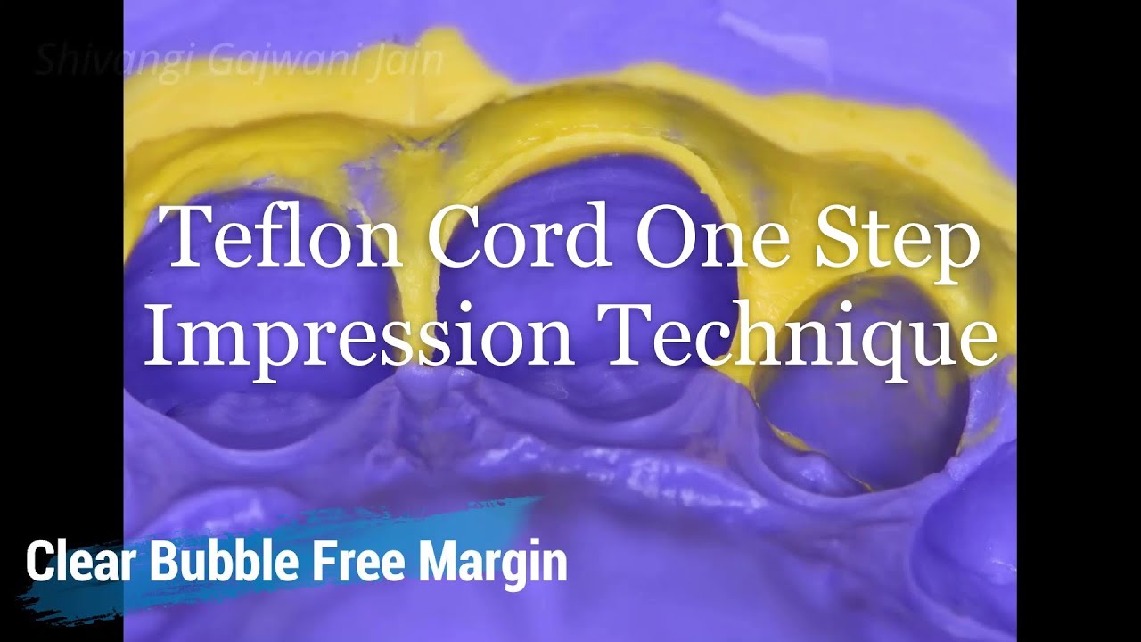 Teflon Cord One Step impression Technique (For Void Free Margins) - YouTube