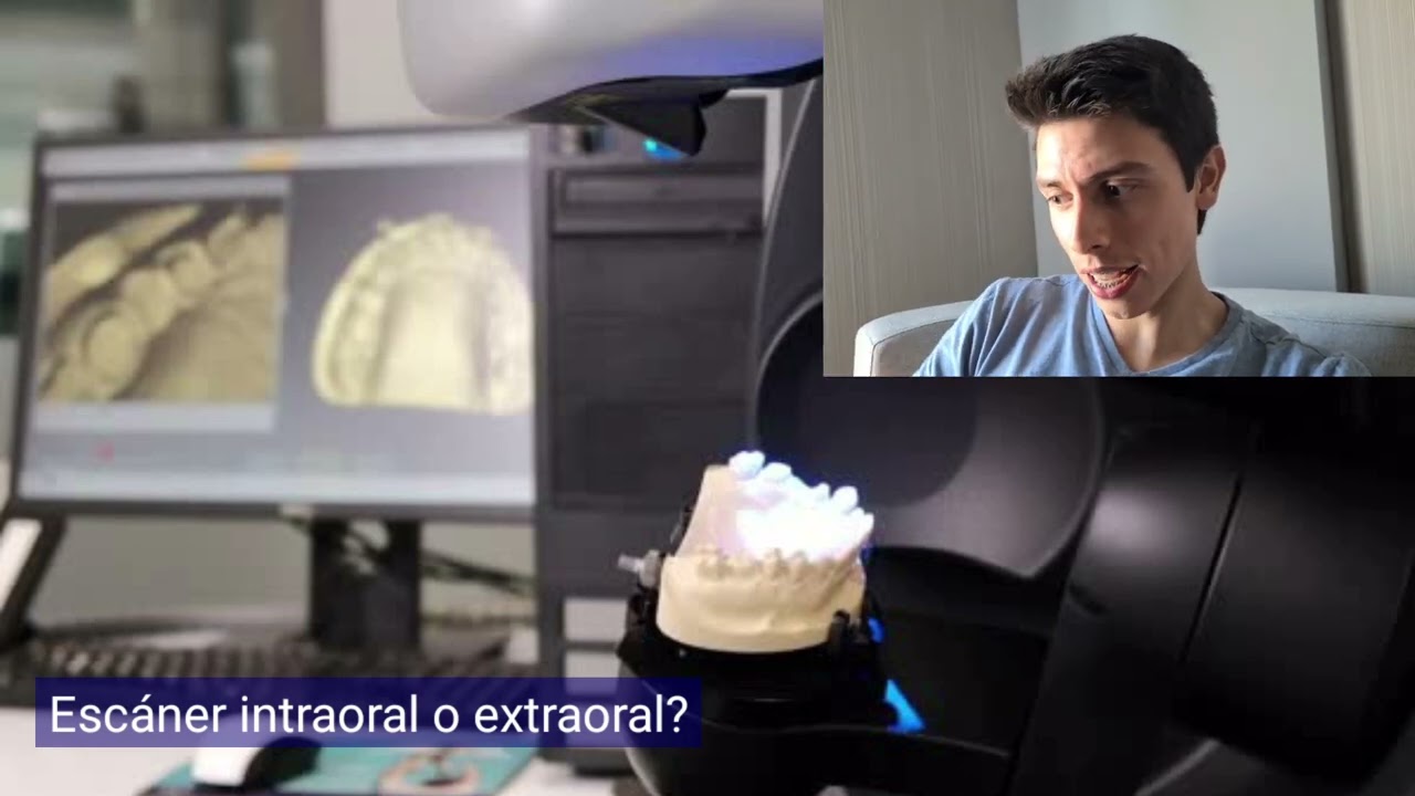 Qué comprar escáner intraoral o escáner extraoral??💥 - YouTube