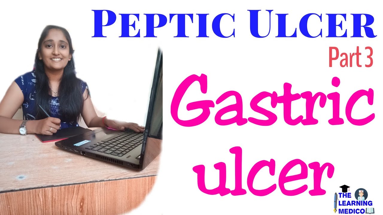 Chronic Peptic Ulcer, Gastric ulcer, The Learning Medico - YouTube