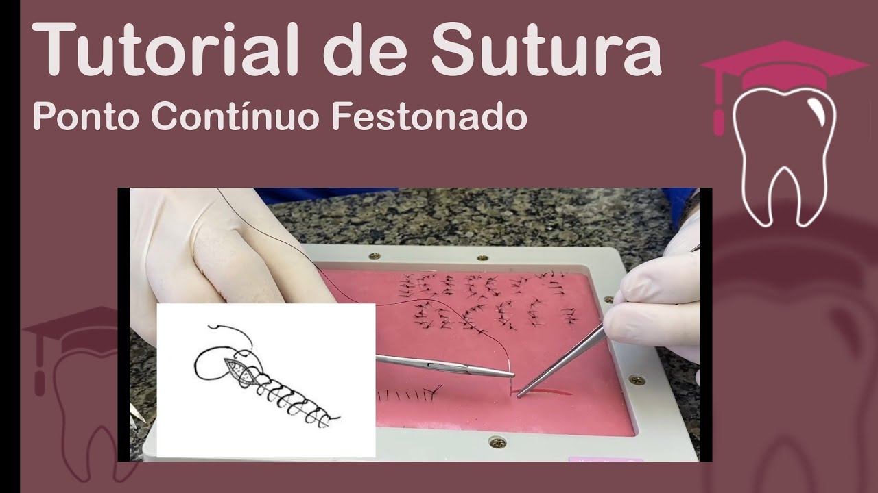 Ponto Contínuo Festonado - Tutorial de Sutura - YouTube