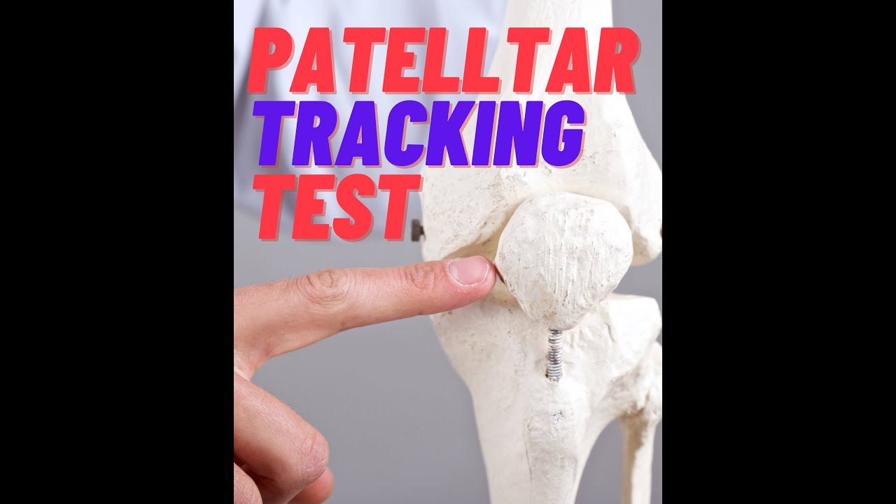 CHECKING YOUR PATELLA, IS IT TRACKING? - YouTube