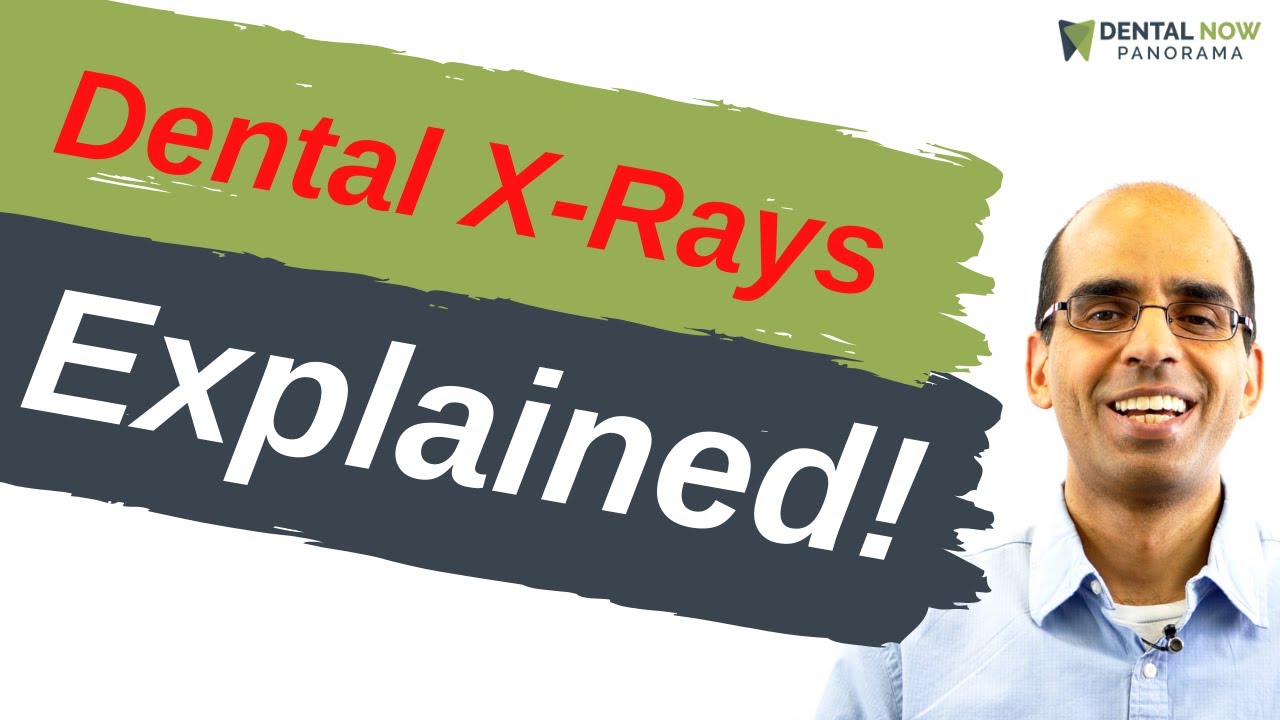Dental X-Rays Procedure | Dentist Explained (2021) - YouTube