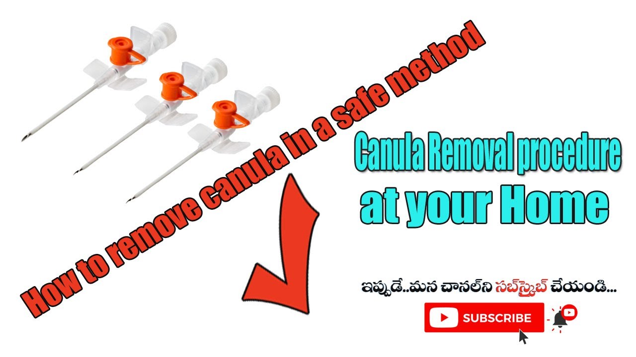 how to remove iv canula safely with out hurting your skin || easy way ...