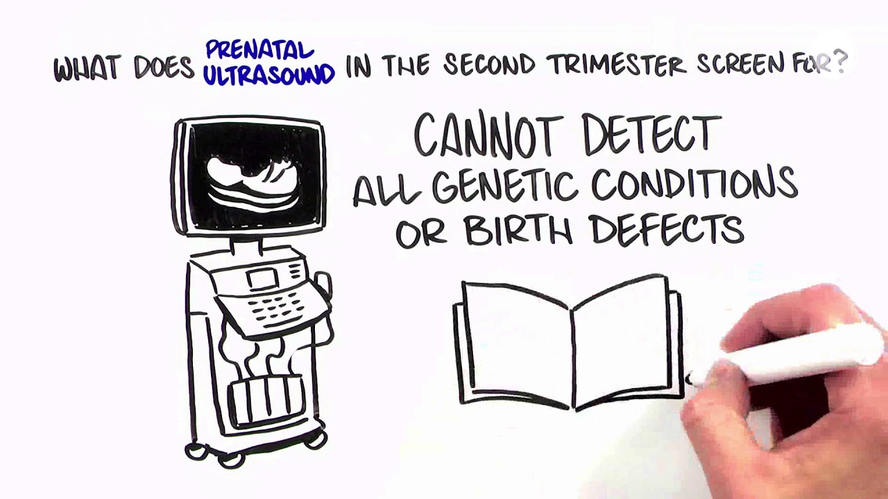 Prenatal Screening Options: Prenatal ultrasound - YouTube