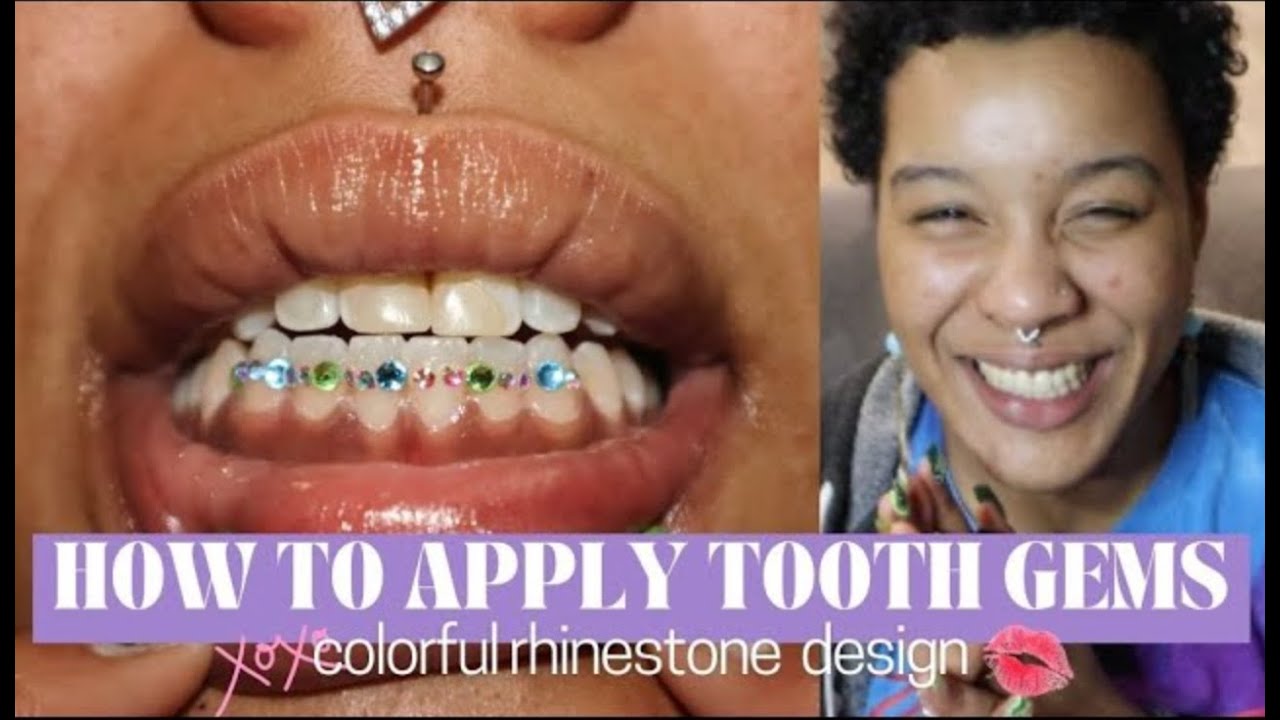 DIY Tooth Gems at home: Colorful tooth gem design + tips & tricks for ...