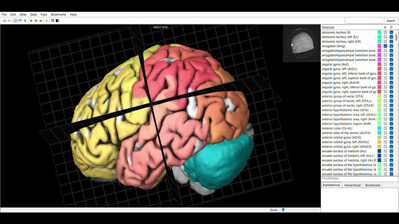 Allen Human Brain Atlas Brain Explorer® 2 2023 08 17 16 18 03 - YouTube