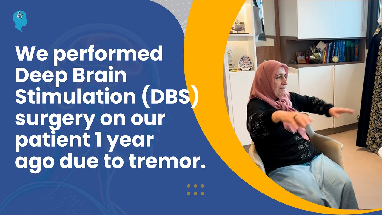We performed Deep Brain Stimulation (DBS) surgery on our patient 1 year ...
