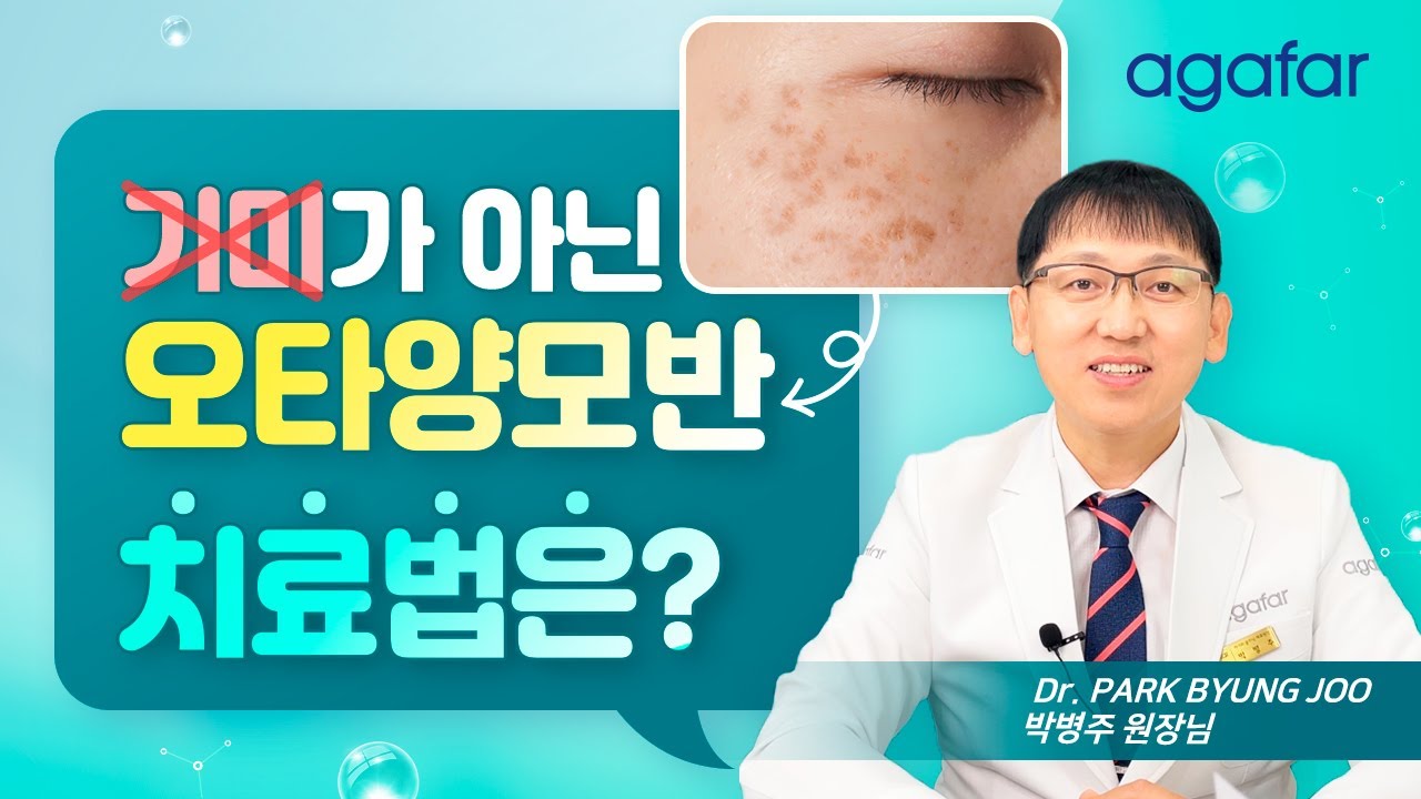 [기미가 아닌 오타양모반 치료법은?] What's the treatment for ABNOM that are not ...
