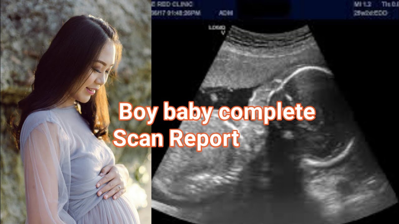 Boy baby symptoms /boy baby anomaly scan in Tamil /pregnancy Scan ...