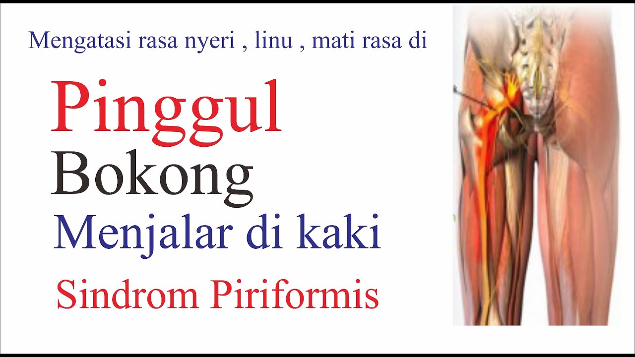 Mengatasi nyeri pinggul,bokong dan kaki bagian atas dengan teknik ...