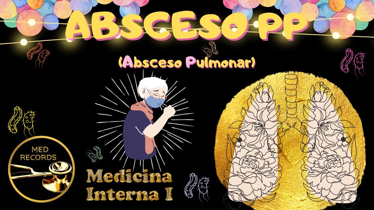 Teoría de Absceso Pulmonar | Medicina Interna | 1ra PARTE | Clínica y ...