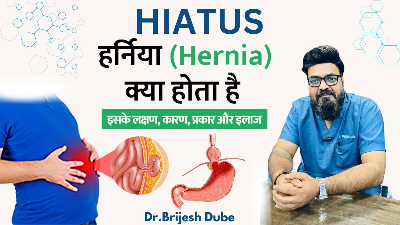 What is Hiatus Hernia? | कितना समय लगता है? | जाने पुरी जानकारी Dr ...