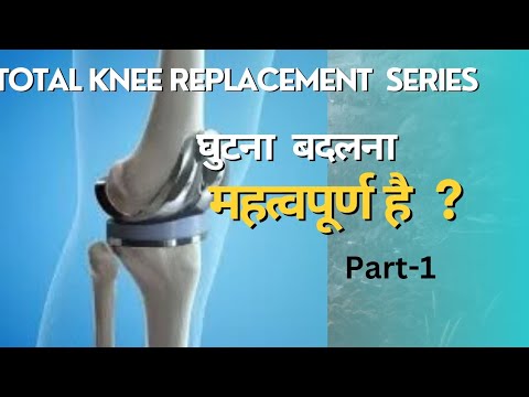 Understanding Need of Total Knee Replacement Surgery (TKR) in Hindi ...